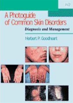 A Photo Guide of Common Skin Disorders Diagnosis and Management 1998 ...