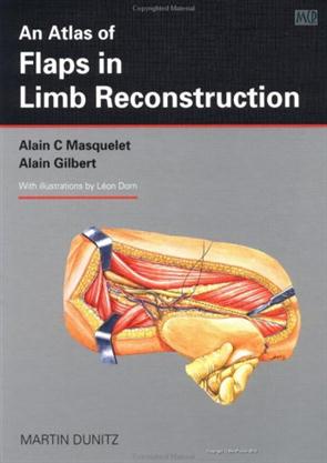 An Atlas Of Flaps In Limb Reconstruction, Medical Books, DTZ