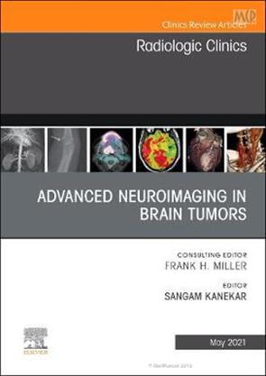 Advanced Neuroimaging in Brain Tumors An Issue of Radiologic Clinics of ...