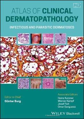 Atlas Of Clinical Dermatopathology Infectious And Parasitic Dermatoses Infectious And Parasitic ...