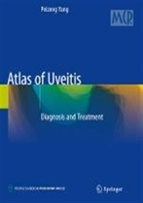 Atlas Of Uveitis Diagnosis And Treatment (Pb 2021), Ophthalmology Books ...