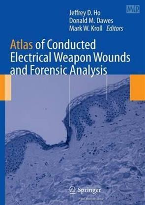 Atlas of Conducted Electrical Weapon Wounds and Forensic Analysis 1st ...