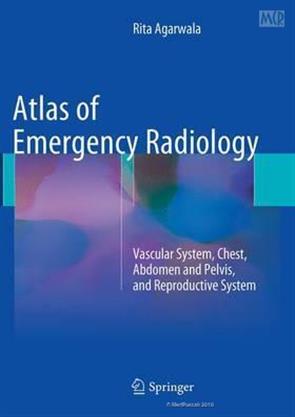 Atlas of Emergency Radiology Vascular System, Chest, Abdomen and Pelvis ...
