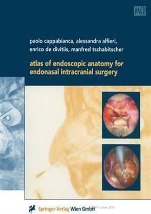 Atlas of Endoscopic Anatomy for Endonasal Intracranial Surgery 1st ...