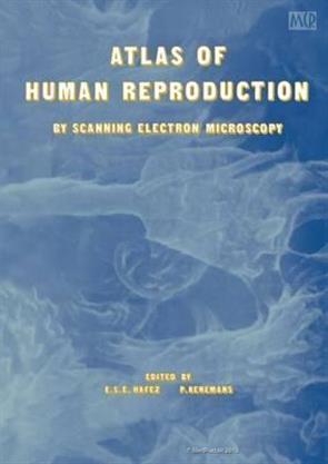 Atlas of Human Reproduction By Scanning Electron Microscopy 1st Editon ...
