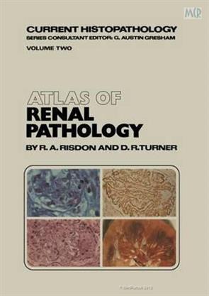 Atlas of Renal Pathology 1st Editon 2013 Softbound, Pathology Books ...