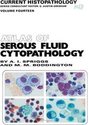 Atlas of Serous Fluid Cytopathology A Guide to the Cells of Pleural, Pericardial, Peritoneal and ...