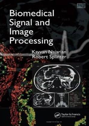 Biomedical Signal & Image Processing, Biomedical & Biomaterials Books ...