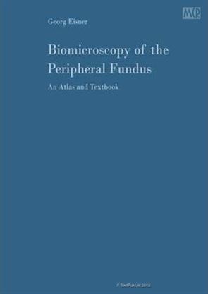 Biomicroscopy of the Peripheral Fundus An Atlas and Textbook 1st Editon ...