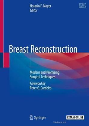Breast Reconstruction Modern and Promising Surgical Techniques 2021 ...