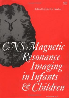 CNS Magnetic Resonance Imaging in Infants and Children, Medical Books ...