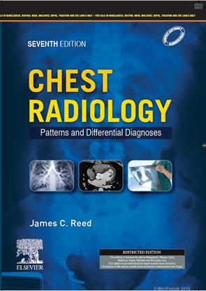 Chest Radiology: Patterns and Differential Diagnoses 7th Edition ...