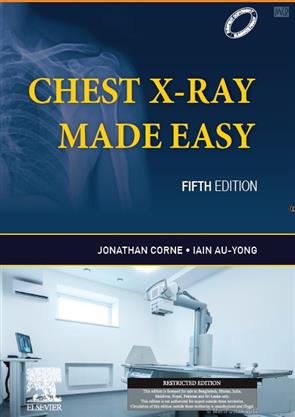 Chest X-Ray Made Easy 5th Edition , Radiology Books, Elsevier