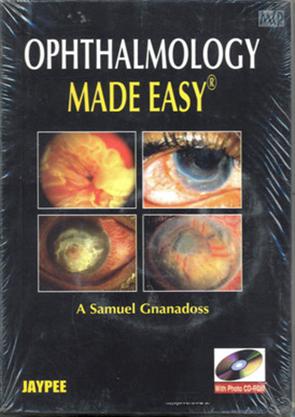 Clinical Ophthalmology Made Easy With Photo Cd-Rom, Ophthalmology Books ...