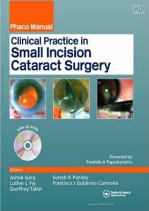 Clinical Practice In Small Incision Cataract Surgery: (Phaco Manual ...