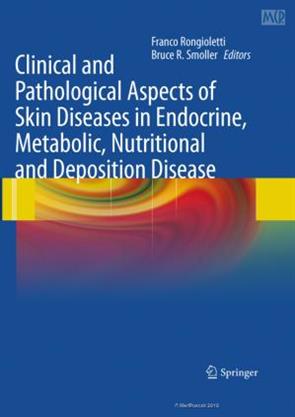Clinical and Pathological Aspects of Skin Diseases in Endocrine ...