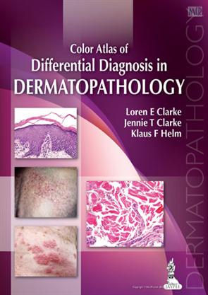Color Atlas Of Differential Diagnosis In Dermatopathology, 1St Edition, Dermatology Books ...