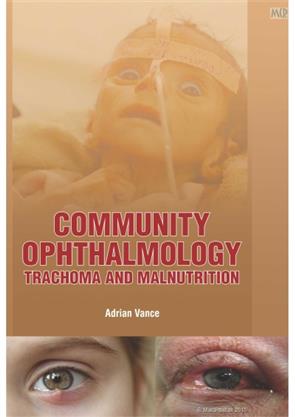 Community Ophthalmology Trachoma And Malnutrition (Hb 2020 ...