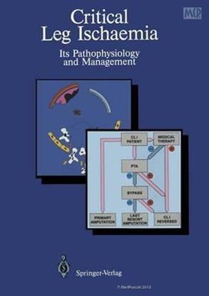 Critical Leg Ischaemia Its Pathophysiology and Management 1st Editon ...