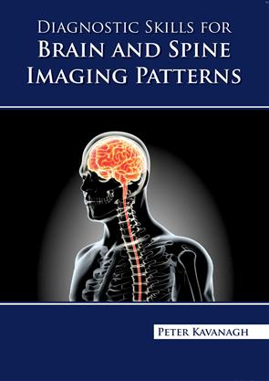 Diagnostic Skills For Brain And Spine Imaging Patterns (Hb 2023)