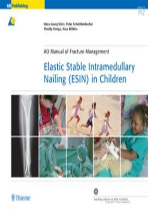 Elastic Stable Intramedullary Nailing (Esin) In Children, Pediatrics Books, Thieme Medical ...