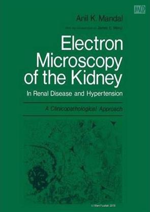 Electron Microscopy of the Kidney In Renal Disease and Hypertension A ...