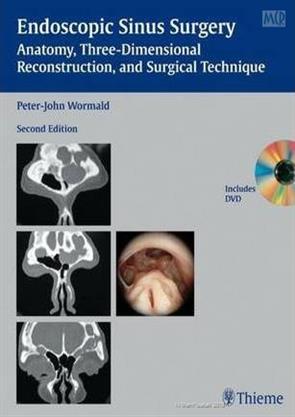 Endoscopic Sinus Surgery Anatomy Three-dimensional Reconstruction and ...