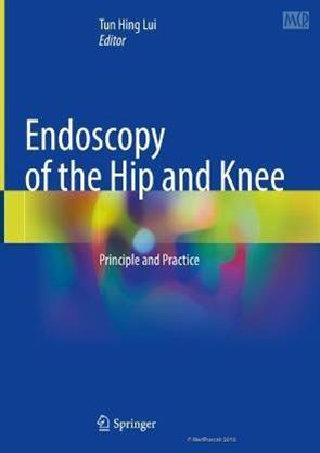 Endoscopy Of The Hip And Knee Principle And Practice 2021 Edition ...
