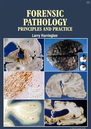 Forensic Pathology Principles And Practice (Hb 2022), Medical Books ...