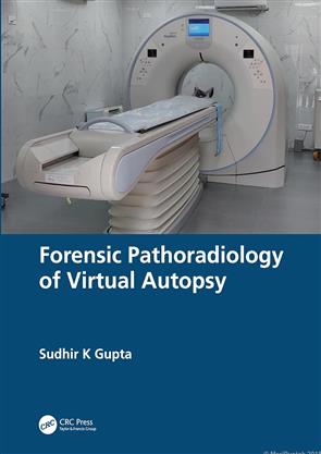 Forensic Pathoradiology Of Virtual Autopsy (Pb 2024)