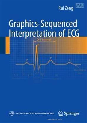Graphics-sequenced interpretation of ECG 1st Editon 2015 Softbound ...