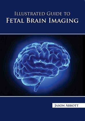 Illustrated Guide To Fetal Brain Imaging (Hb 2023)