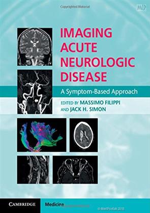 Imaging Acute Neurologic Disease A Symptom-Based Approach, Neurology ...
