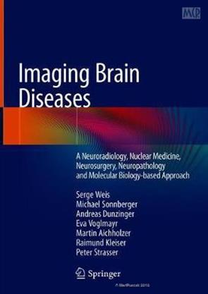 Imaging Brain Diseases A Neuroradiology Nuclear Medicine Neurosurgery Neuropathology and ...