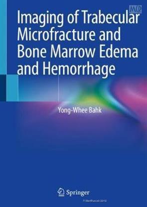 Imaging of Trabecular Microfracture and Bone Marrow Edema and ...