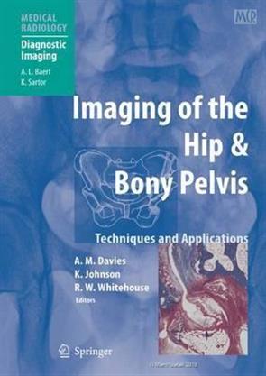 Imaging of the Hip & Bony Pelvis Techniques and Applications 1st Editon ...