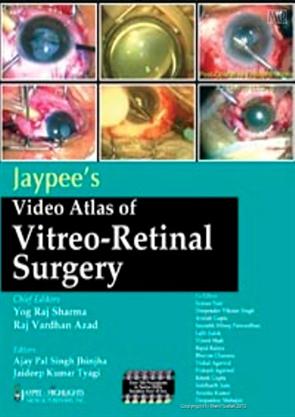Jaypee Video Atlas Of Vitreo-Retinal Surgery With 12 Dvd-Roms 1St ...