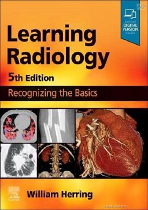 Learning Radiology Recognizing The Basics With Access Code 5Ed (Pb 2024 ...