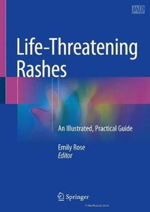 Life Threatening Rashes An Illustrated Practical Guide 1st Editon 2018 ...