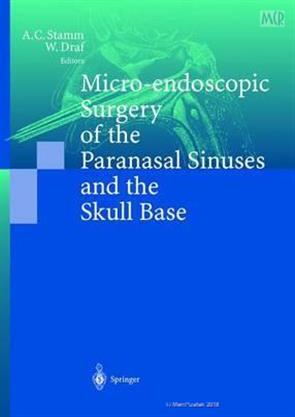Micro endoscopic Surgery of the Paranasal Sinuses and the Skull Base ...
