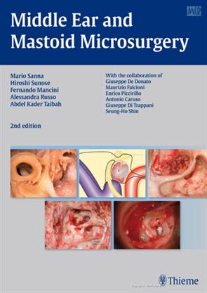Middle Ear And Mastoid Microsurgery 2Nd Edition, Surgery Books, Thieme ...