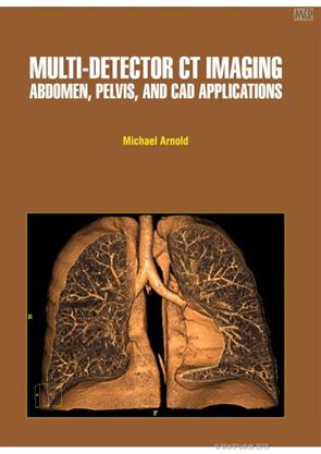 Multi Detector Ct Imaging Abdomen Pelvis And Cad Applications (Hb 2020 ...