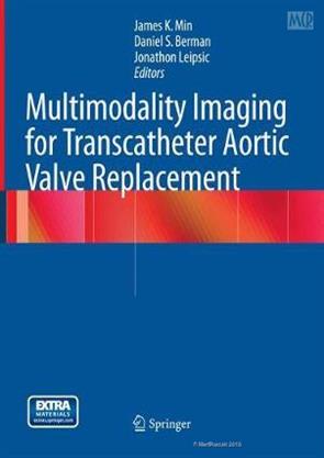 Multimodality Imaging for Transcatheter Aortic Valve Replacement 1st ...