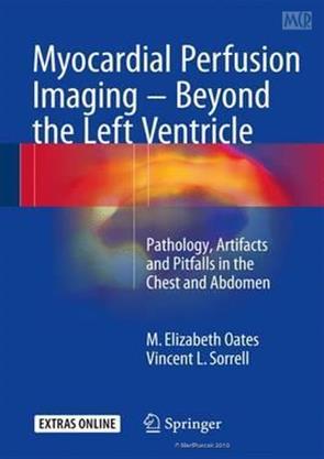 Myocardial Perfusion Imaging Beyond the Left Ventricle Pathology ...