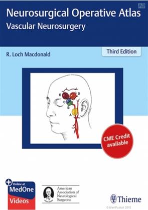 Neurosurgical Operative Atlas Vascular Neurosurgery 3Rd Edition (Hb ...