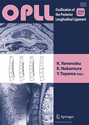 OPLL Ossification of the Posterior Longitudinal Ligament 2nd Edition ...