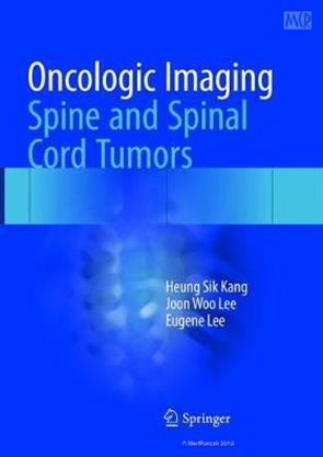Oncologic Imaging Spine and Spinal Cord Tumors 1st Editon 2018 ...