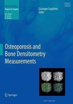 Osteoporosis and Bone Densitometry Measurements 1st Editon 2015 ...