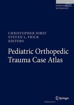 Pediatric Orthopedic Trauma Case Atlas (Hb 2020), Orthopaedics Books ...