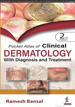 POCKET ATLAS OF CLINICAL DERMATOLOGY WITH DIAGNOSIS AND TREATMENT 2ND ...